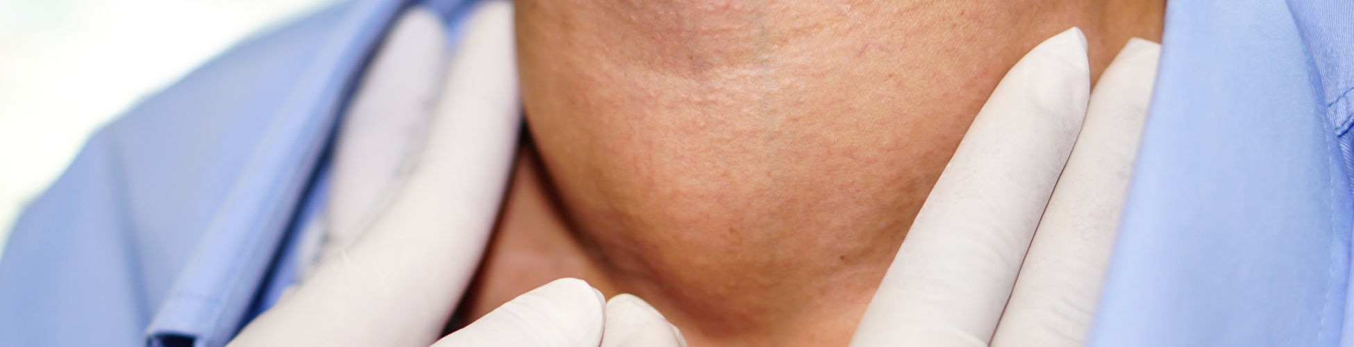 Lumps and Bumps Removal | Chroma Dermatology
